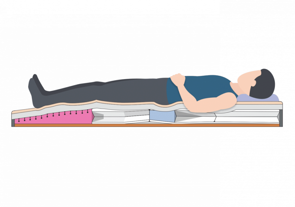 Mattress Hybrid - Forte Alaise Pumpless Hybrid | Balance Mobility